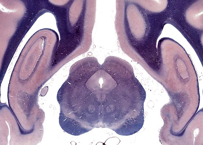 Canine Brain Section 8