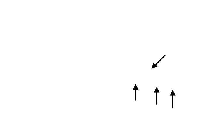 Manual Bladder Expression
